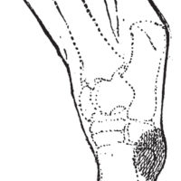 Synovialitis / Synovitis am Knie - Symptome und Therapie