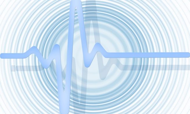 Palpitation